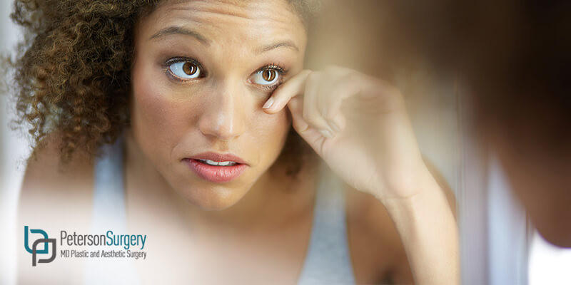 Will Eyelid Surgery Change My Eye Shape? | Kelowna Plastic Surgery